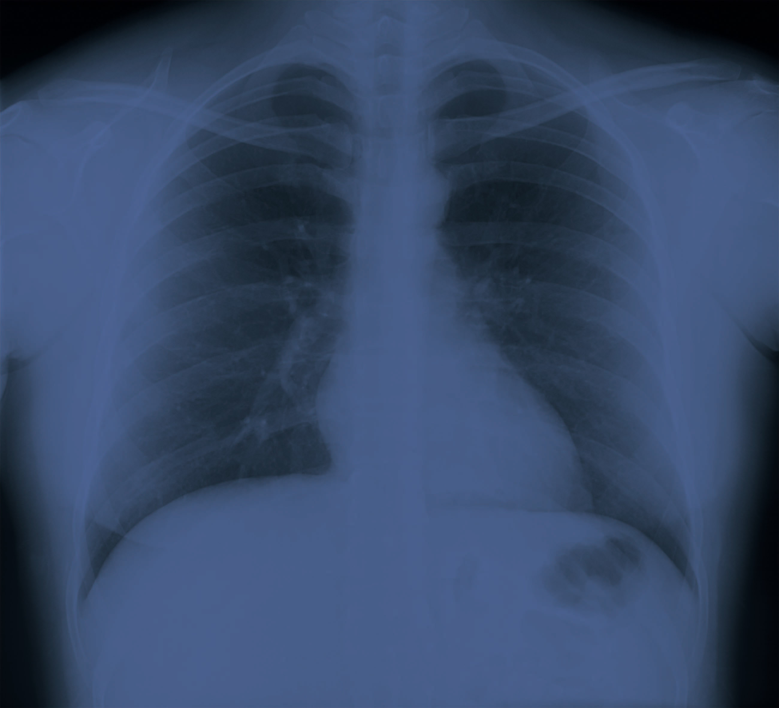 H5N1 de evolutie van een griepvirus